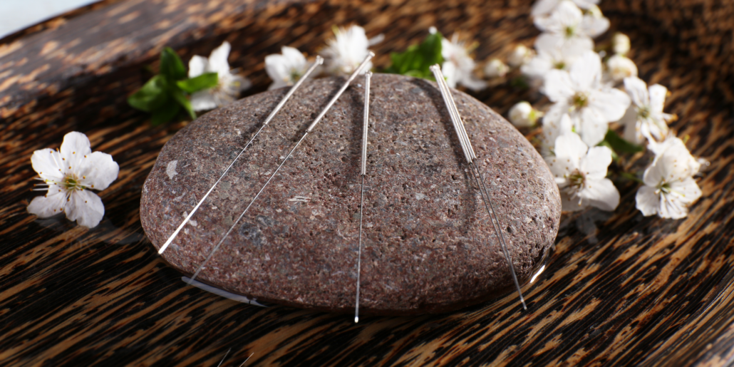 Unveiling the Hidden Benefits of Acupuncture - Acupuncture - Spiritual ...